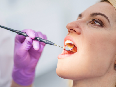 Tooth Extractions - Open Wide La Jolla Dentistry