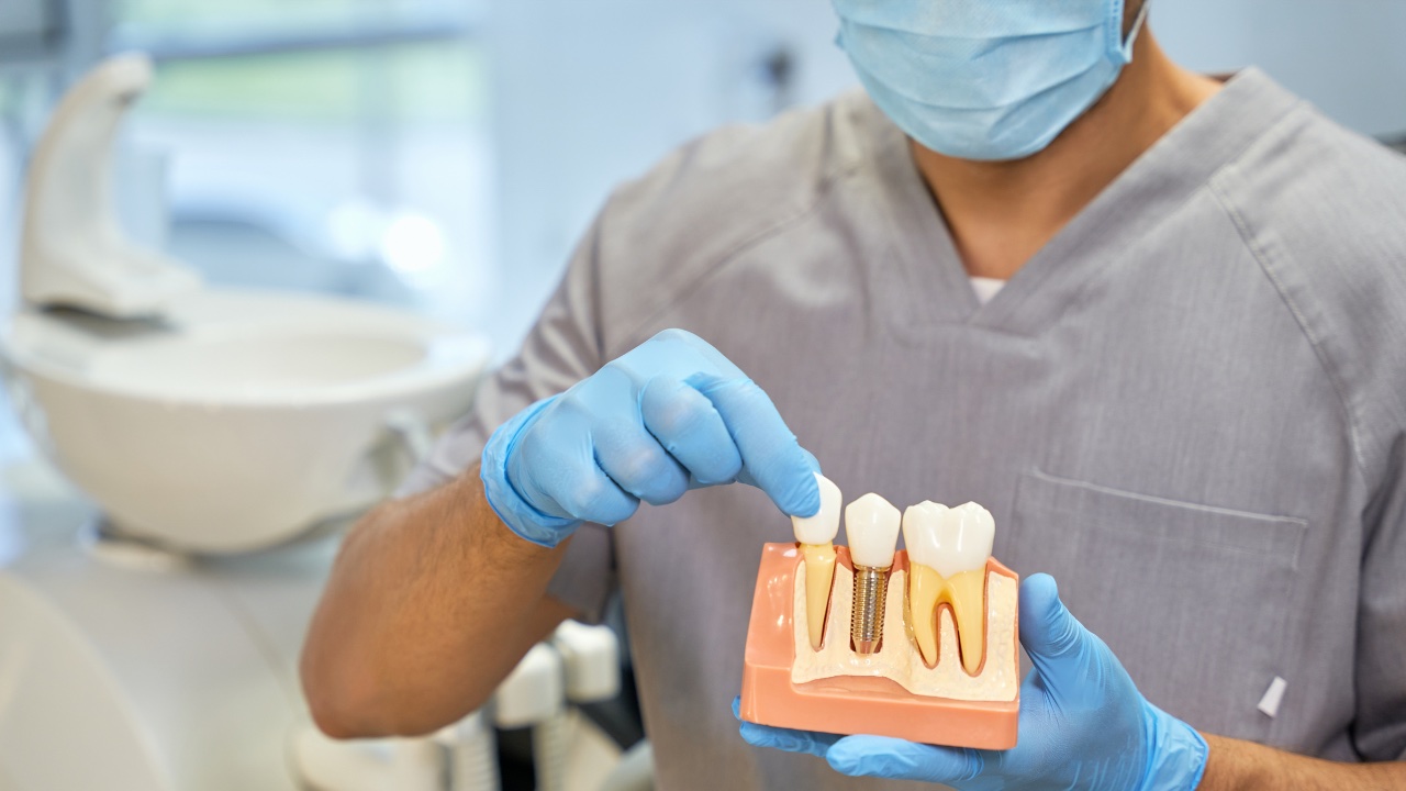 Advanced Dental Implant Dentistry | Dental Implants in La Jolla